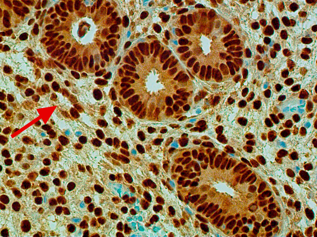 The Endometrial Cycle | GLOWM